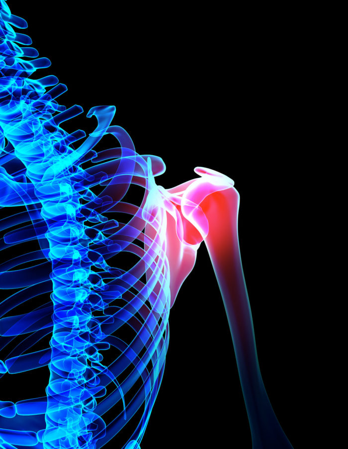 New techniques help some shoulder surgeries - S. Florida Business & Wealth